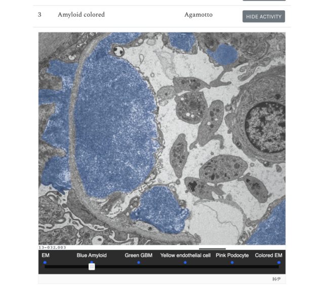 How to Scout For H5P Examples – The H5P Kitchen